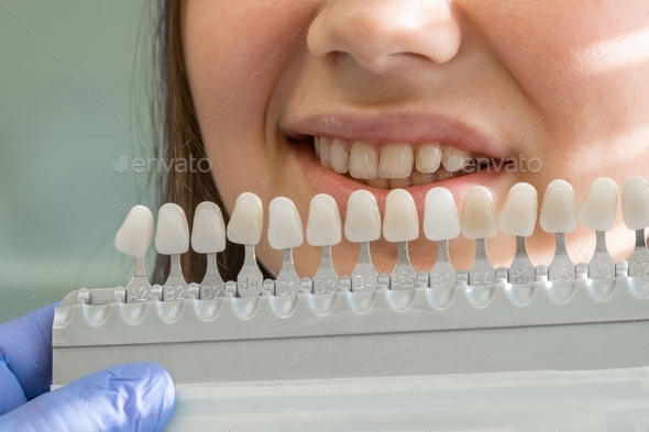 Dentist selects color palette for dental treatment smiling woman at ...