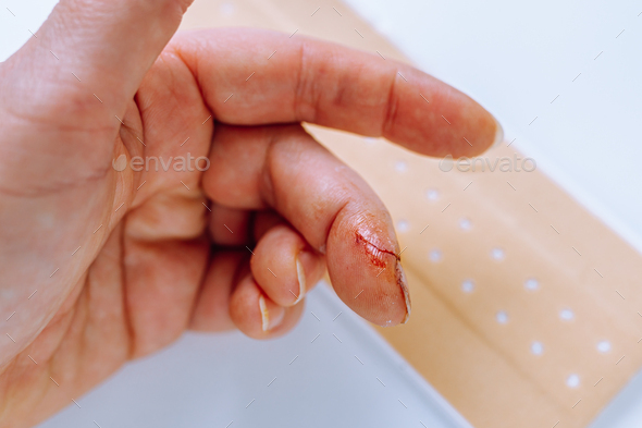 cut injury from a knife or sharp object on the finger Stock Photo by ...