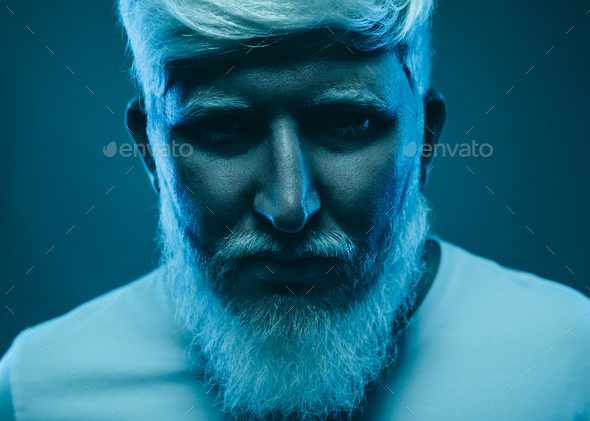 Serious adult man with albinism looking at camera Stock Photo by kegfire
