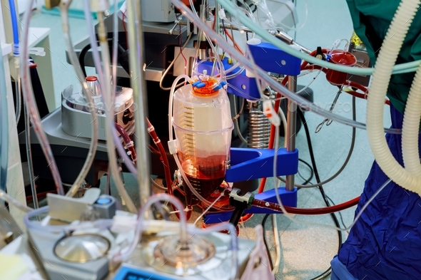 Transfusion and infusion at surgery Blood transfusion to patient at ...