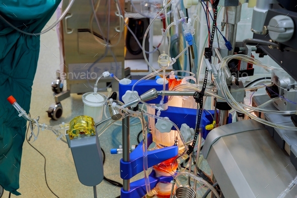 Cardiopulmonary bypass CPB machine connected and in use, also known as ...