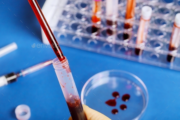 Hand holding blood sample vial in laboratory tube test Stock Photo by ...