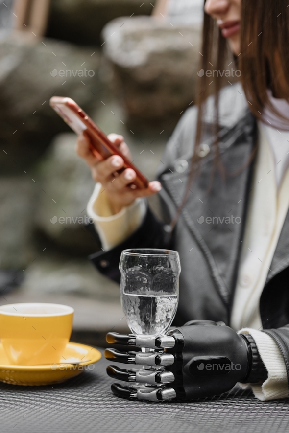 Bionic prostheses for people with limb amputation. Stock Photo by myjuly