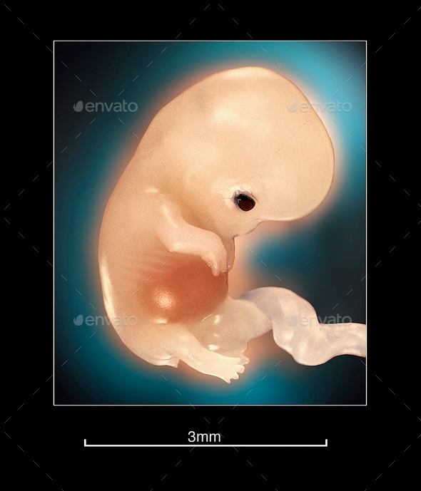 Human fetus in the womb prior to birth Stock Photo by SteveAllenPhoto999