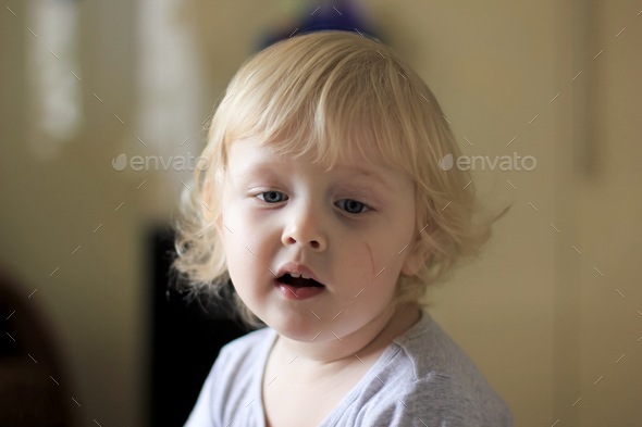 A close up portrait of cute blond little boy with a scratch on his ...