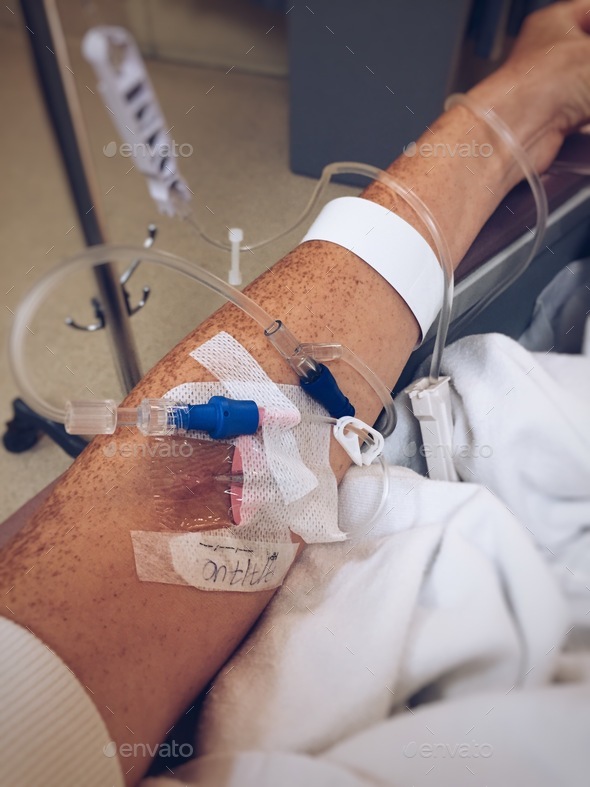 Arm of a female patient with an IV, receiving intravenous fluids or ...