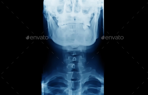 x-ray image of human body Stock Photo by FoToArtist_1 | PhotoDune