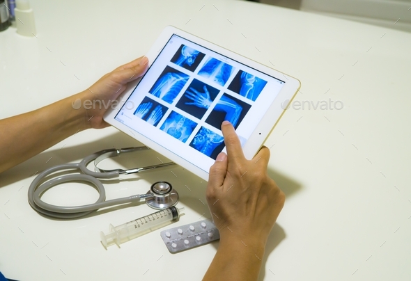 closeup on a doctor woman sitting at his office desk observing a x-ray ...