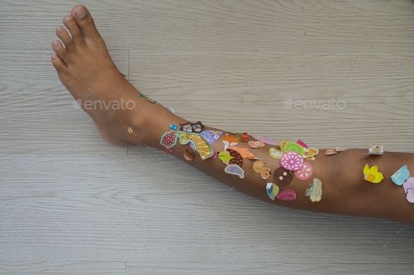 Different stickers pasted on the leg of a child. Playing and being ...
