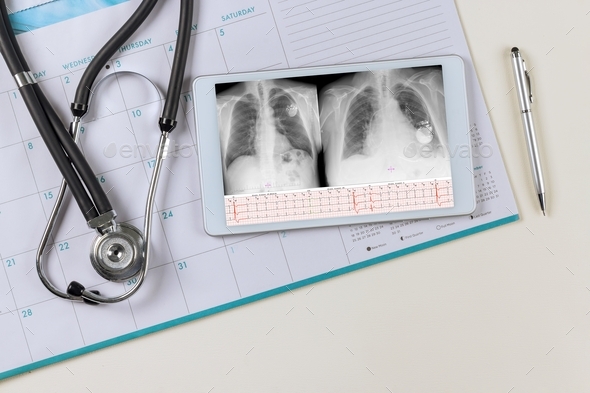 The doctor checks the correctness work of the pacemaker on the digital ...