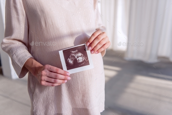 Pregnant young woman holds an ultrasound scan in hands, the fetus is ...