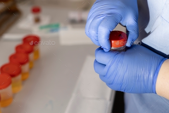 Analysis in a medical laboratory. Stock Photo by timofeevavalentina_foto