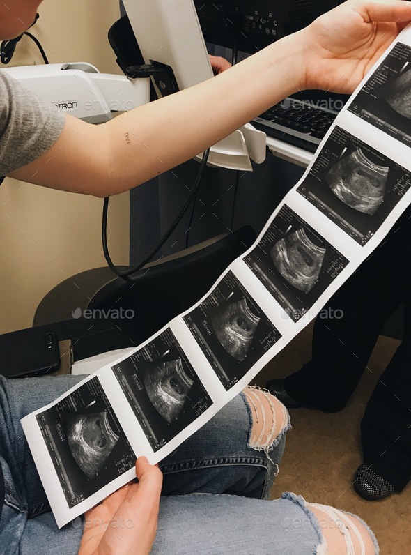 Young mom holding up a strip of ultrasound photos at her first doctor ...