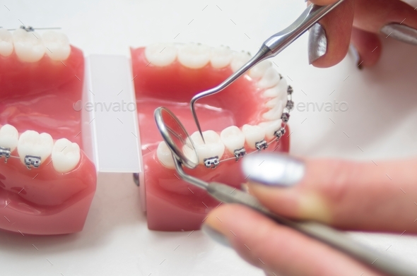 the dentist studies the correction of teeth on the model with the help ...