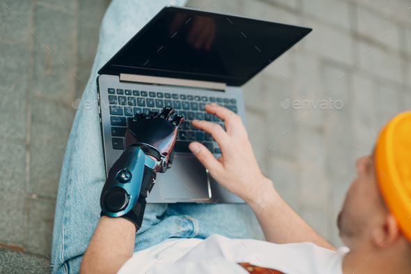Young disabled man with artificial prosthetic hand using typing on ...
