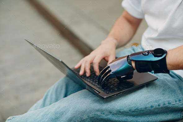 Young disabled man with artificial prosthetic hand using typing on ...