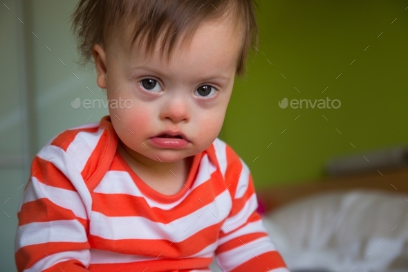 Portrait of cute baby boy with Down syndrome Stock Photo by TDyuvbanova