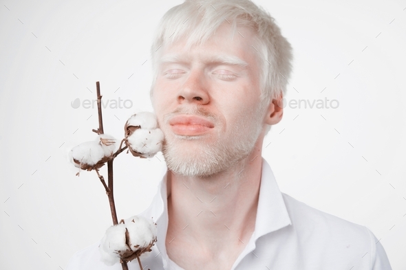 Albino man on white background with cotton plant. Albinism Stock Photo ...