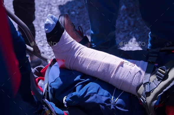 Mountain rescue service provide first aid to person with broken leg ...