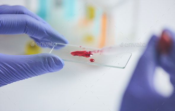 Examining blood sample on microscope slide Stock Photo by Media_photos
