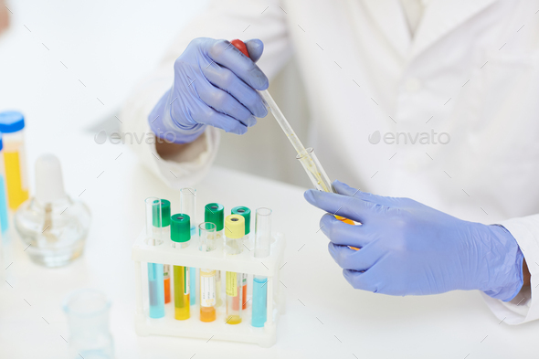 Preparing sample for laboratory testing Stock Photo by Media_photos