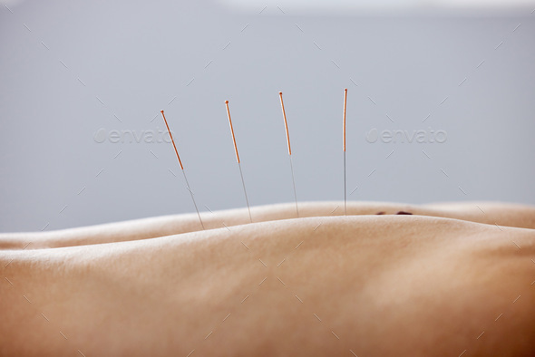 Stick some needles on your body. Shot of a man using acupuncture ...
