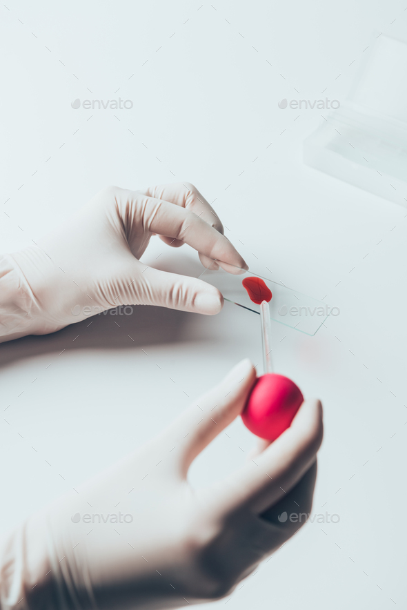 cropped shot of doctor pouring blood from pipette onto blood slide ...
