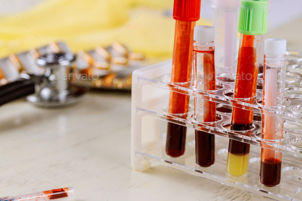 Medical working with blood sample in laboratory Stock Photo by photovs