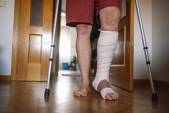 Injured man with bandaged foot walking at home with walking sticks ...