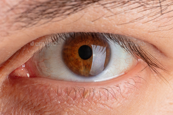 wide open human eye close up Stock Photo by traimakivan | PhotoDune