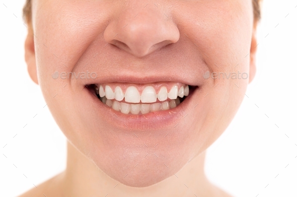 Lower half of woman face close up, smile with open mouth and white ...