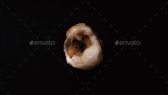 Macro shot of a decayed teeth till root after extraction of dentist. Stock Photo by gnepphoto