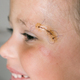 Closeup smiling patient kid girl face with stitches, joint on scratch ...
