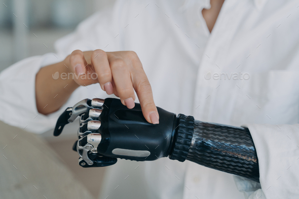 Woman with disability turns on high tech prosthetic arm, showing bionic ...