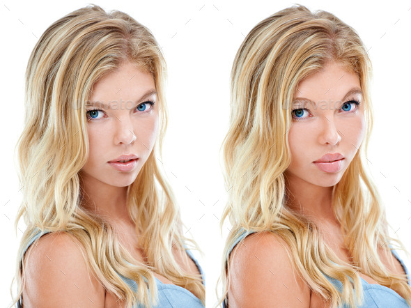 Comparative composite image of a before and after plastic surgery ...