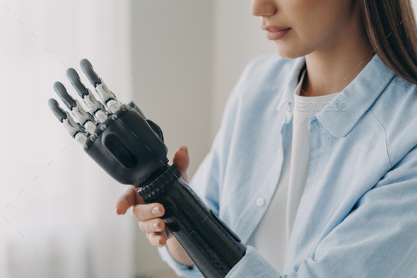 Disabled girl touches her bionic prosthetic arm. Medical high tech care ...