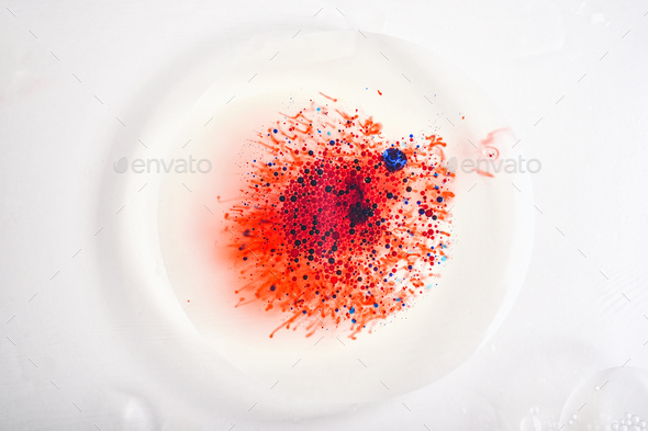 Blood cell smear under microscope for vaccine research, Bacterias and ...