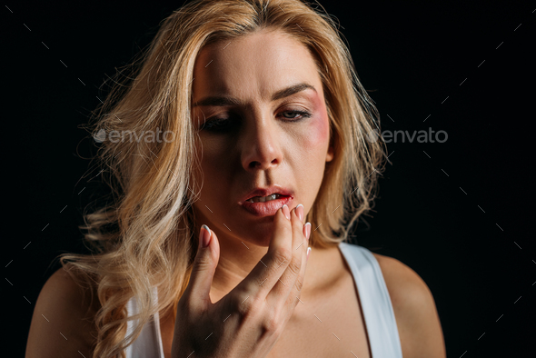 Victim with bruise touching face isolated on black Stock Photo by ...