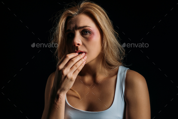 Victim with bruise on face looking at camera and touching lips isolated ...