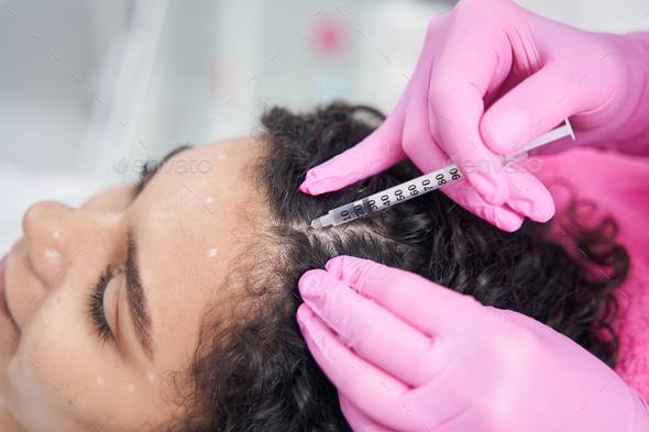 Beautician inserting a syringe needle into the scalp of patient Stock ...