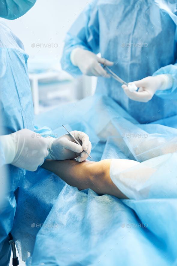 Surgical operation of lower limb conducted by professional doctor Stock ...