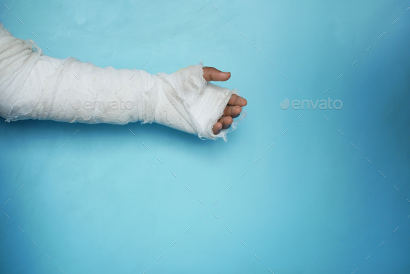 injured painful hand with bandage against blue background Stock Photo ...
