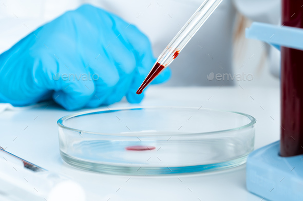 Medical equipment for blood test close up Stock Photo by FabrikaPhoto