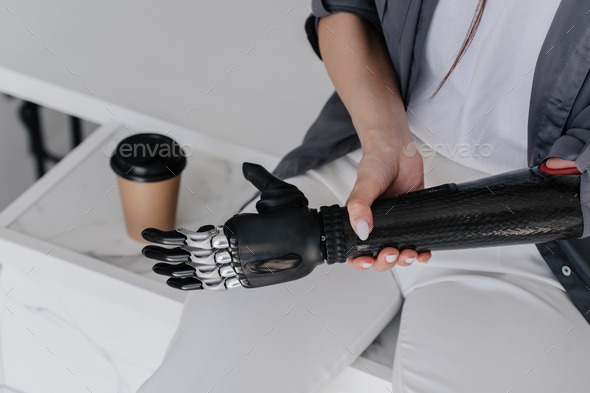 Girls hand adjusts bionic hand prosthesis. Cropped shoot of girl ...