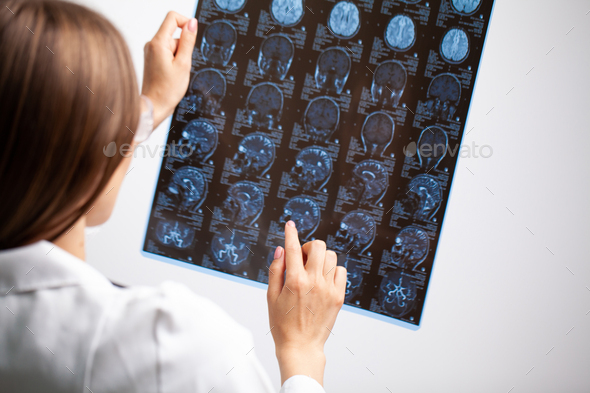 Beautiful female radiologist looking at the MRI scan images Stock Photo ...