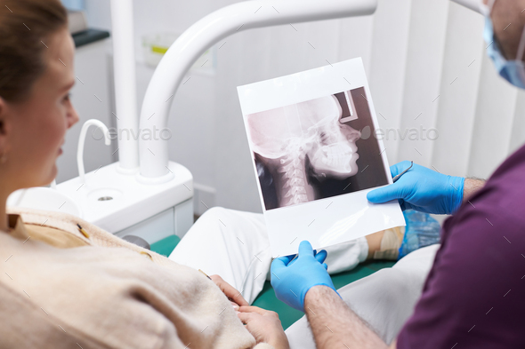 Focus on X-Ray orthopantomogram in the hands of a dentist consulting ...