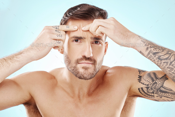 Face, portrait and skin of man with acne or pimple problem with ...