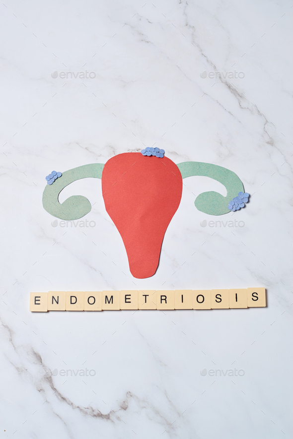 Female uterus with endometriosis, female wellness care concept Stock ...