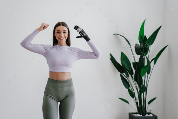 young woman standing at home, with bionic hand prosthesis, smiling ...