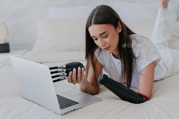 girl with disability with in white t-shirt connecting artificial palm ...